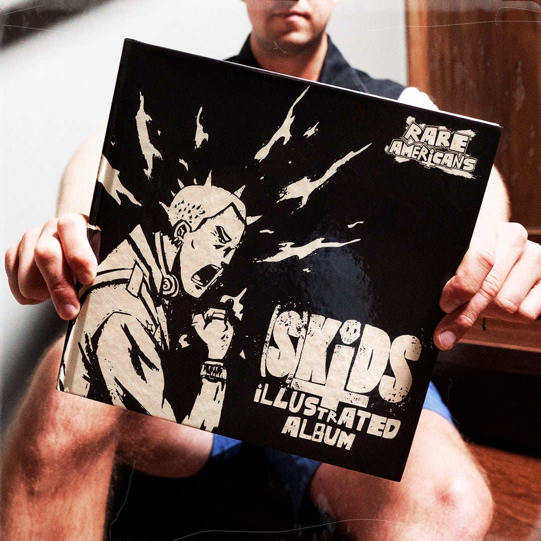 (S)KiDS - Rare Americans